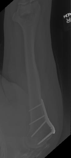 Humerus Segmentation Semantic Segmentation Dataset and Pre-Trained Model by HumerusSegmentation