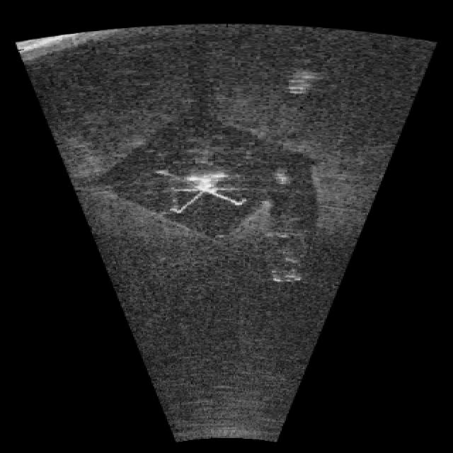 shen-na-seg Instance Segmentation Dataset by mydata