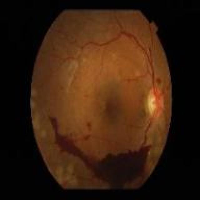 eye-detect Object Detection Dataset and Pre-Trained Model by CCUTZBY