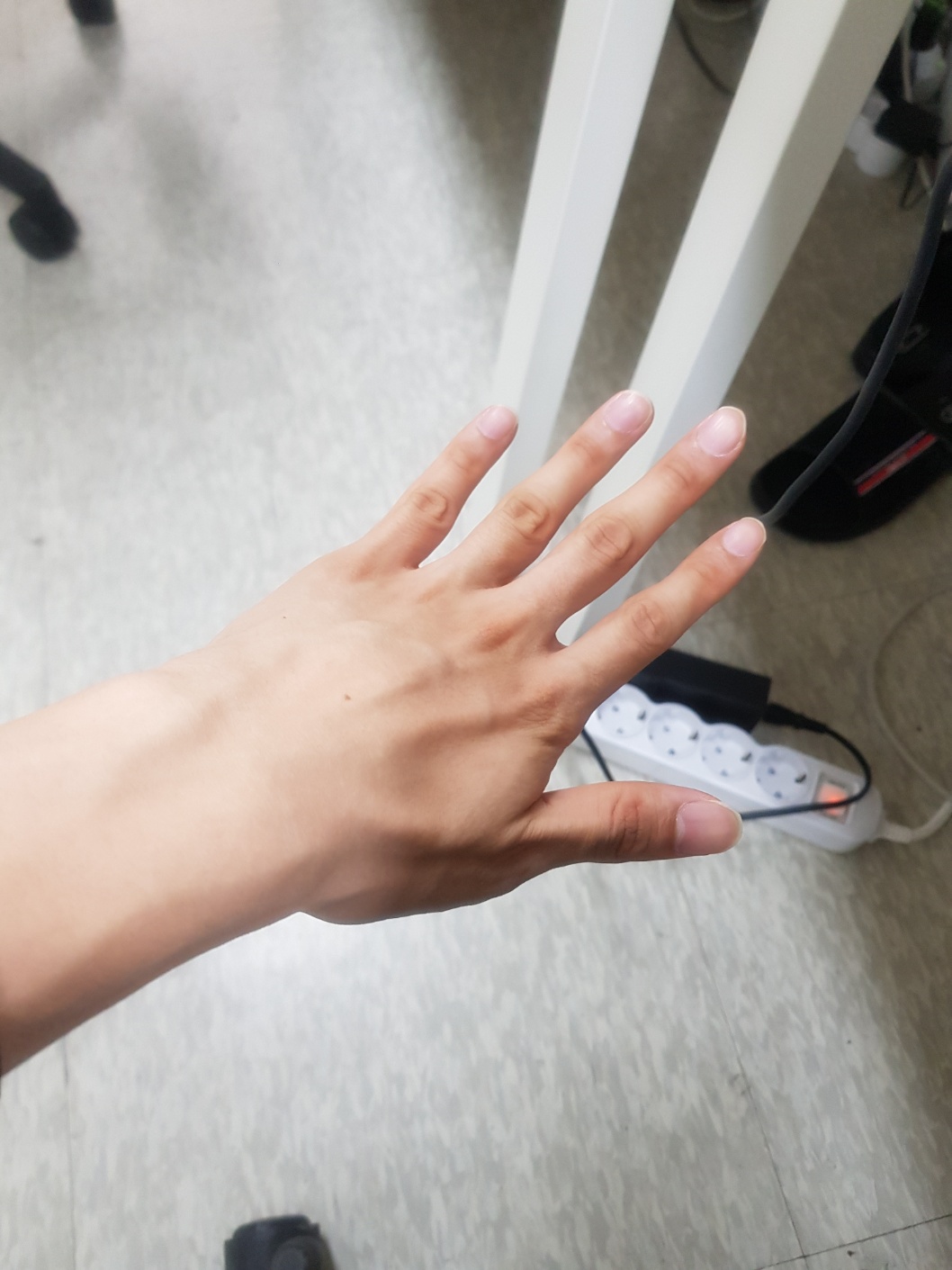 onion_ABCD Object Detection Dataset by jimin