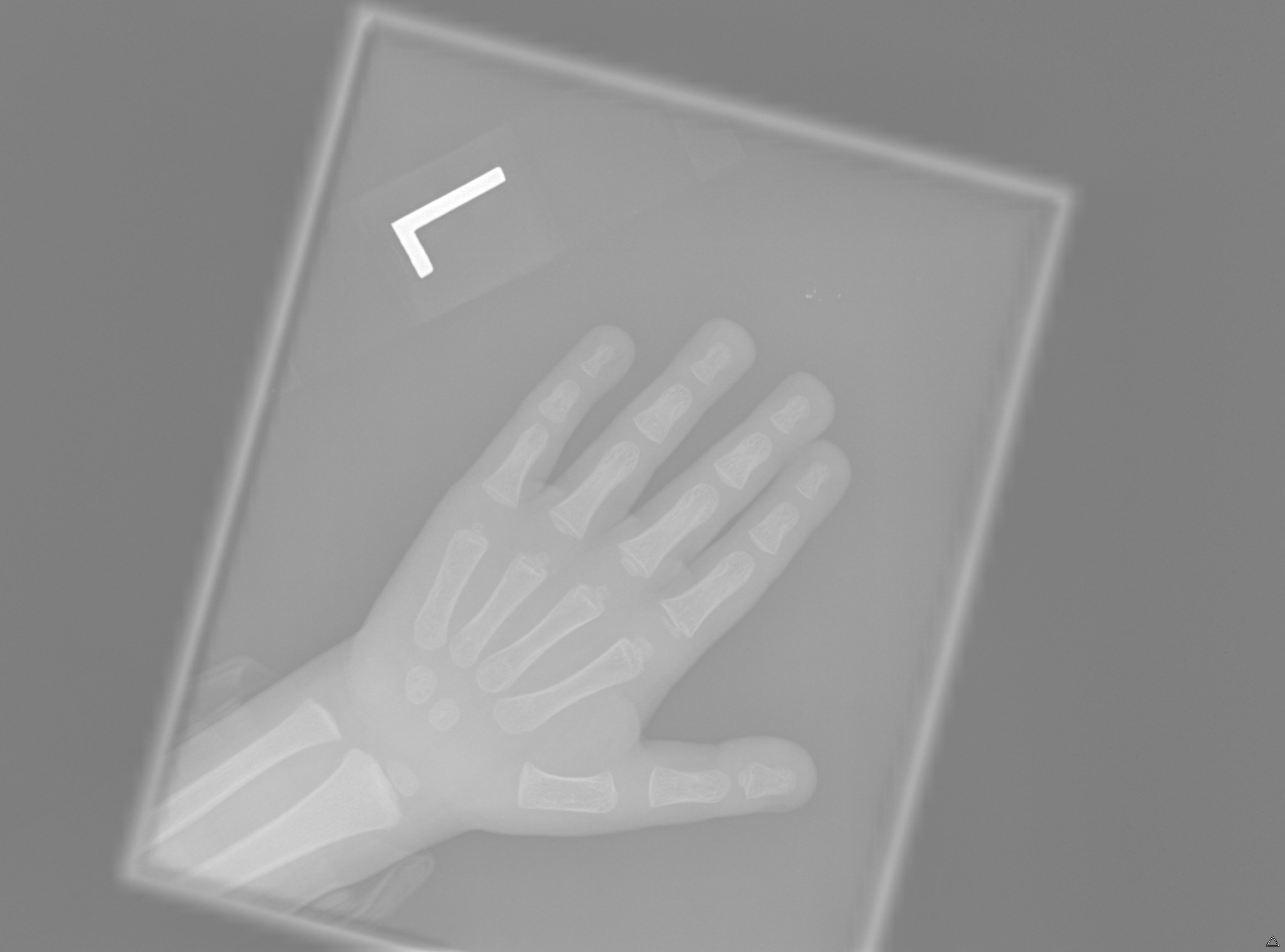 joints-3 Object Detection Dataset and Pre-Trained Model by joints3