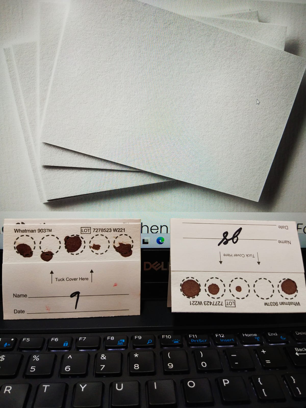 Seg_Bloodsample Instance Segmentation Dataset by CV