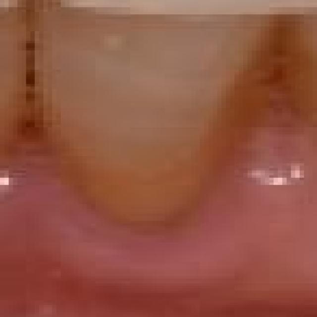Teeth Detection Object Detection Dataset And Pre Trained Model By Pilotcode