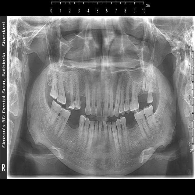 Dental X Ray Instance Segmentation Dataset by PLe1908