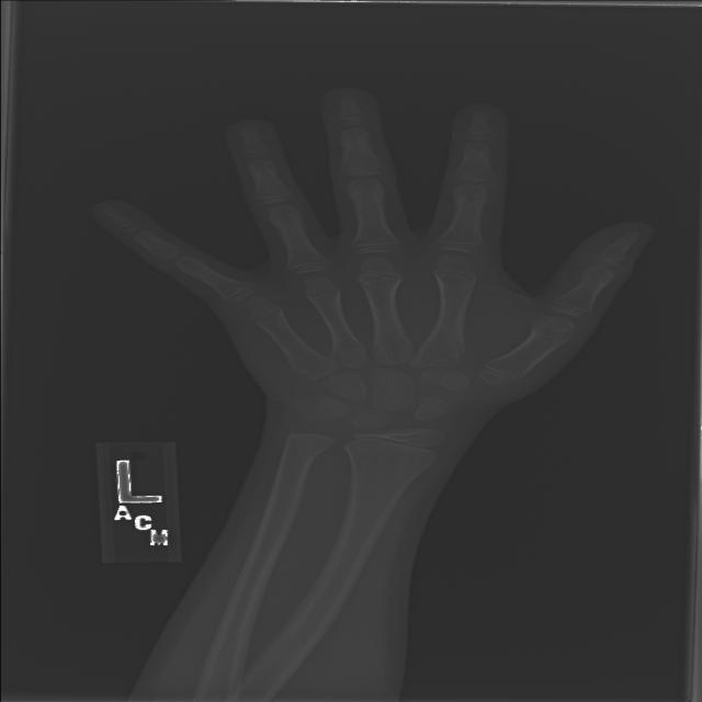 bone segmentatio Object Detection Dataset by DWI BLEED DETECTION