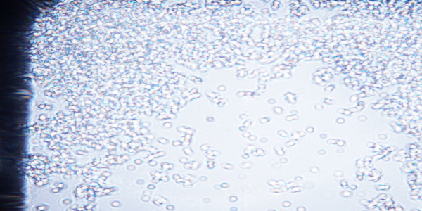 cells detection Object Detection Dataset and Pre-Trained Model by Yasmine Zouggagh