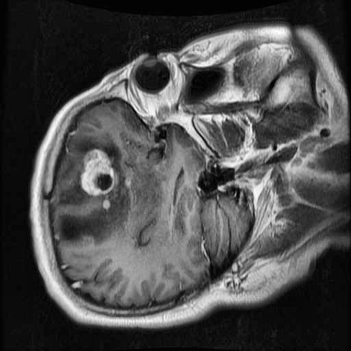 pthd - Roboflow Universe