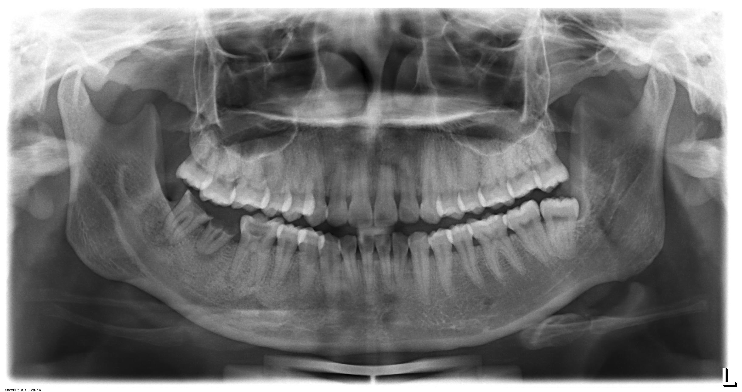 vqc (vqc-4q8hn) - Roboflow Universe