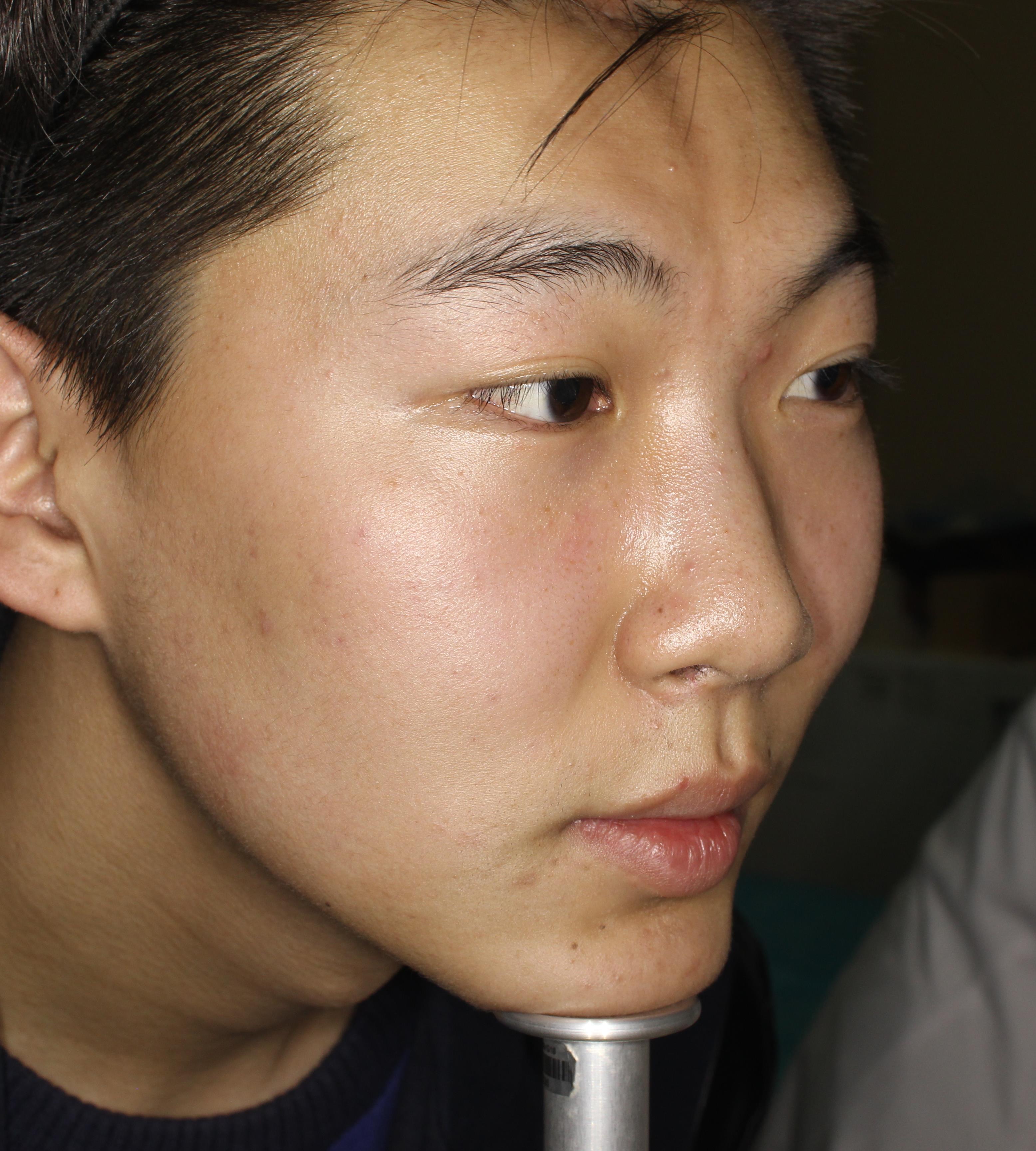 Umer (umer-jjskc) - Roboflow Universe