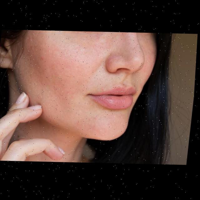 normal skin Classification Model by HI