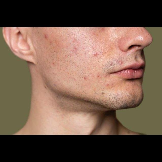 skin-model-yolo Object Detection Dataset by Skin
