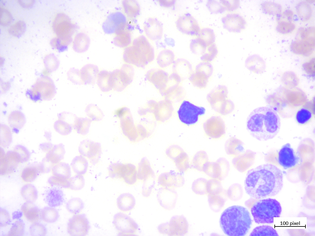 Blood cells Classification Dataset by unitec