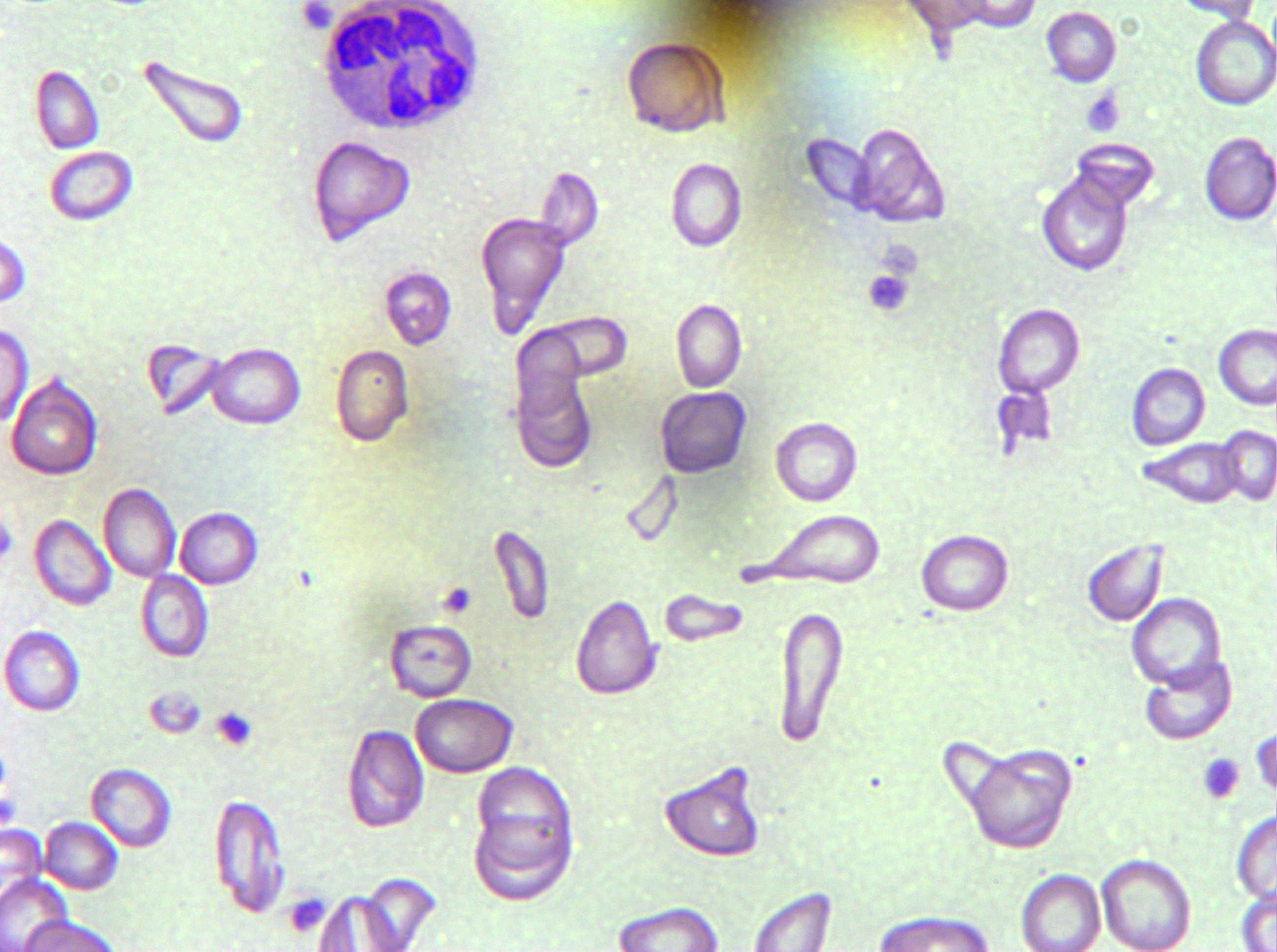 bloodcell Object Detection Dataset by blood