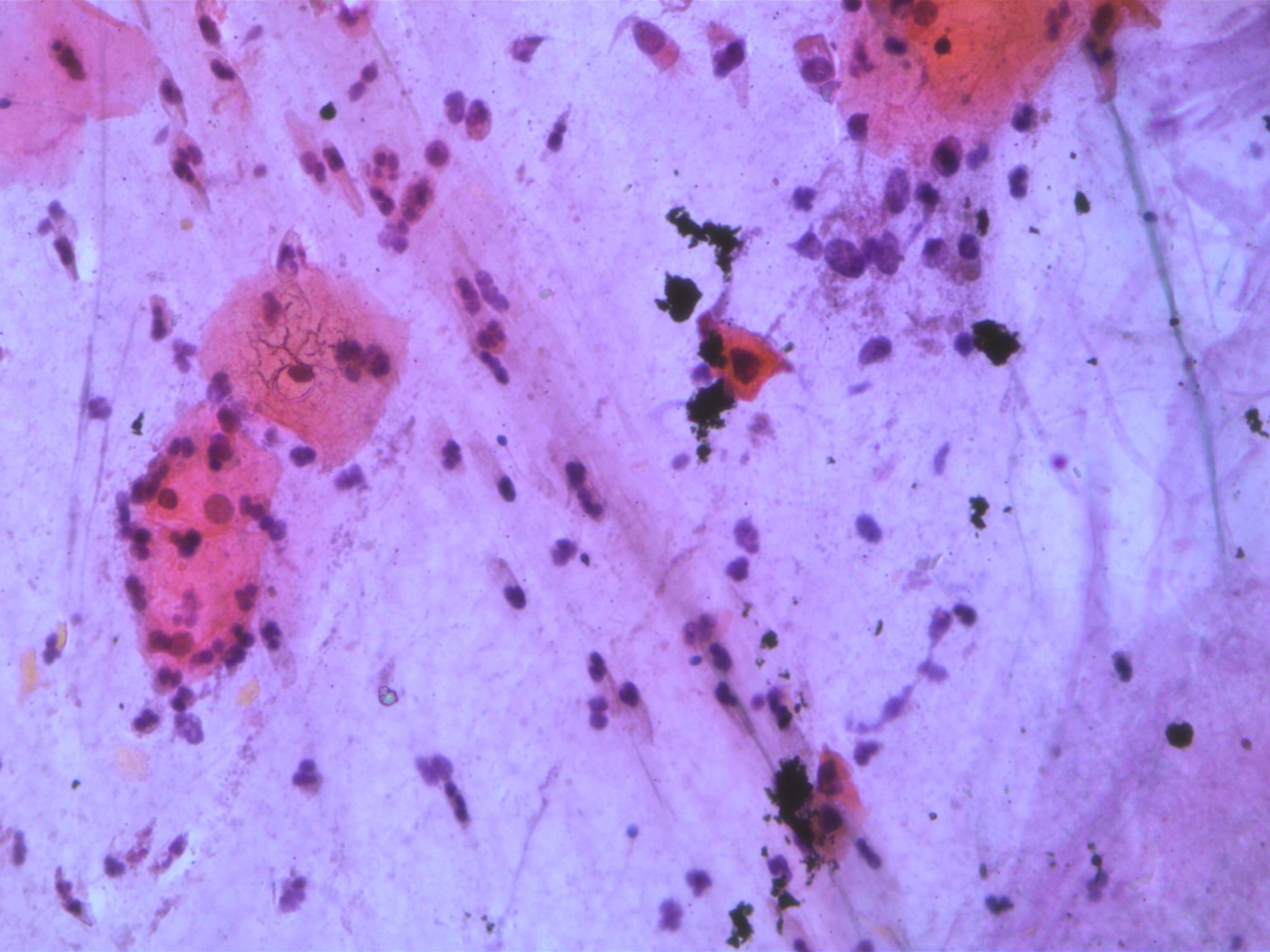 SIPaKMeD Object Detection Dataset by Ik zu quan