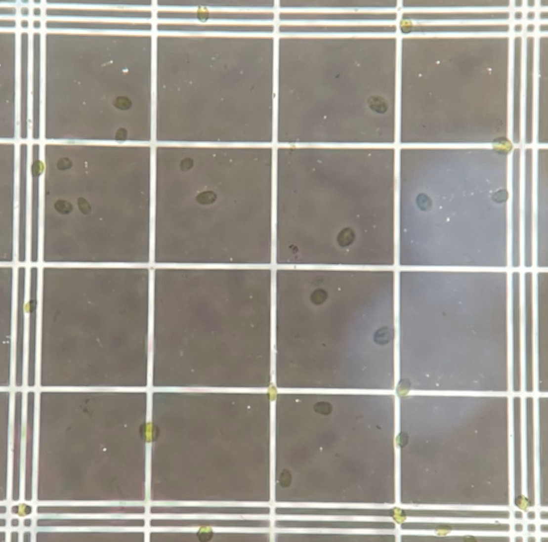 Eiei Object Detection Model By B