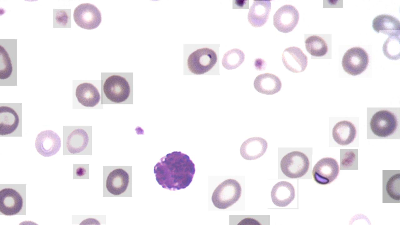 cell blood Object Detection Dataset by duc