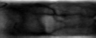 detectionVeine1 Object Detection Dataset and Pre-Trained Model by Project1