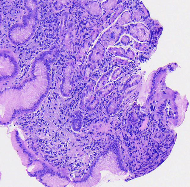 Yolov8 Inflammation Detection Object Detection Dataset And Pre Trained Model By Yolov8