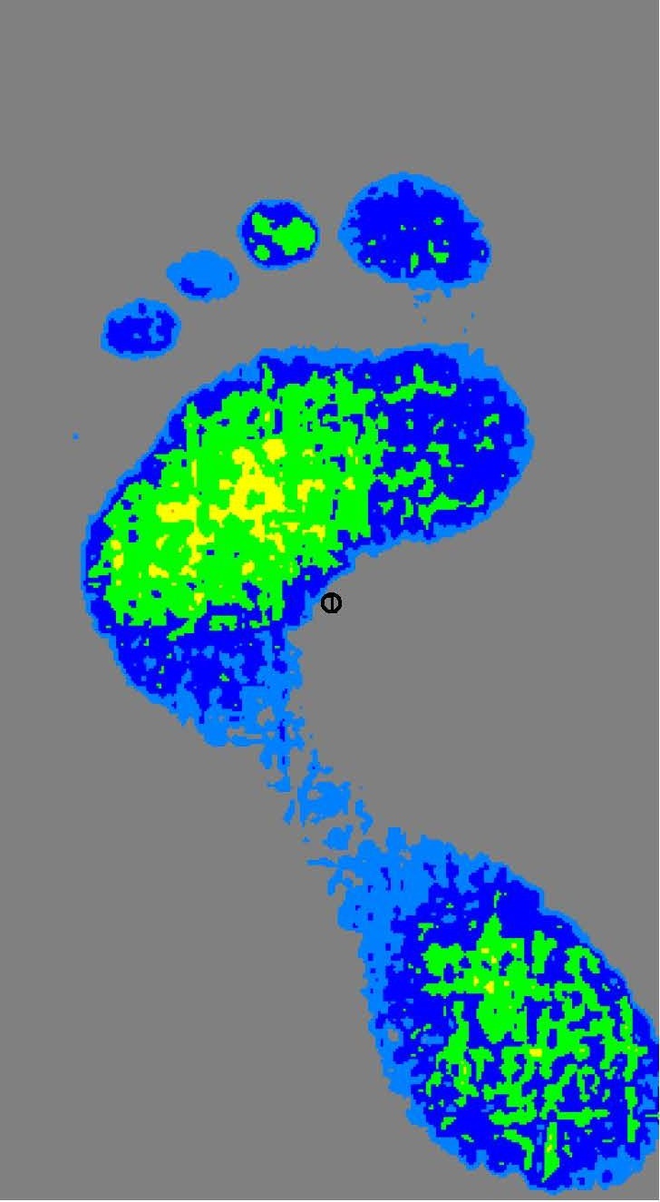Foot Labelling Project Instance Segmentation Dataset By Talha Rehman