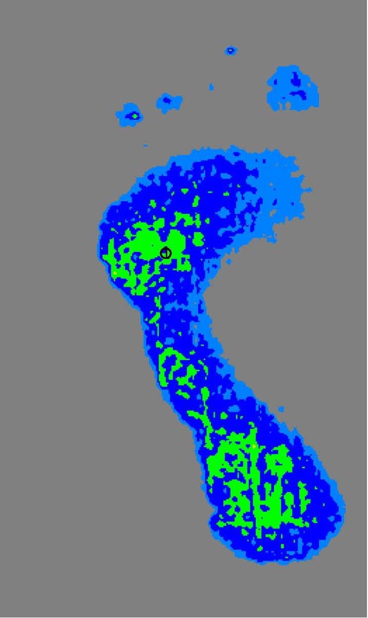 Foot Labelling Instance Segmentation Dataset By Talha Rehman