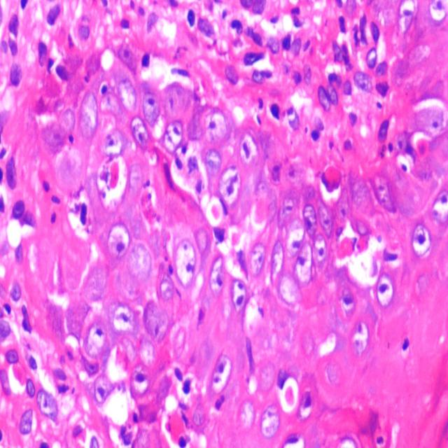 Multiple_nucleoli nas Object Detection Model by OxRxAxL