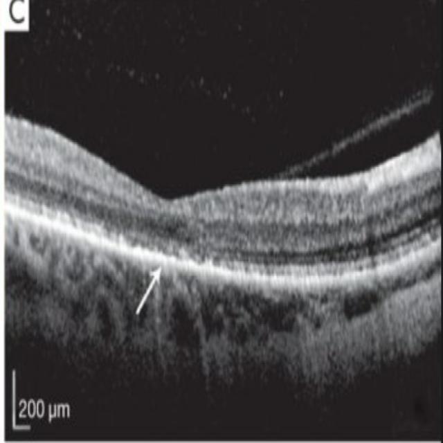aaaa Instance Segmentation Dataset by projects