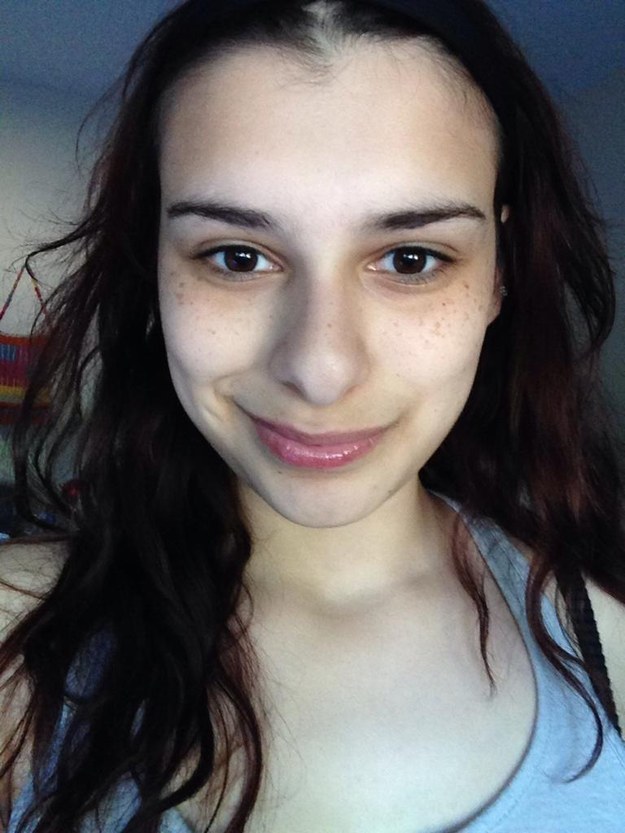 Skin Problems Object Detection Dataset and Pre-Trained Model by FinalYearProject