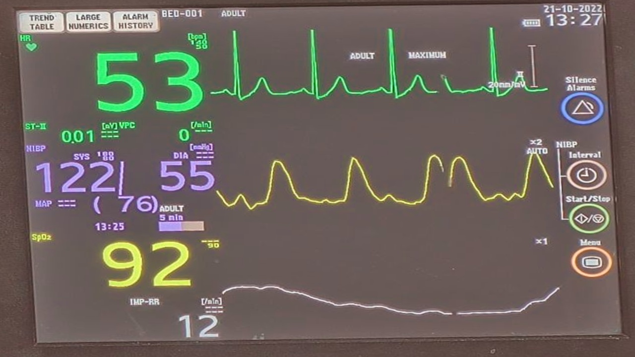 Good Valid Object Detection Dataset And Pre Trained Model By Finalshow