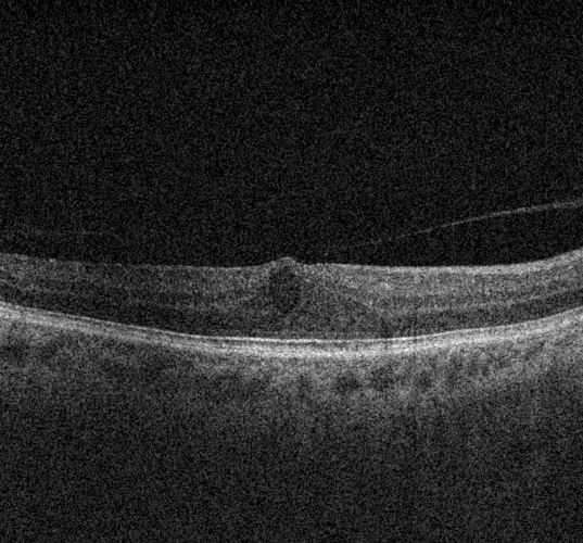 ERM classification Classification Model by Freshw4ter