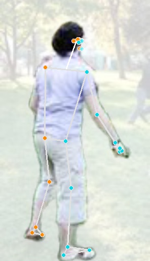 Upper Arm Final Object Detection Dataset And Pre Trained Model By Tese