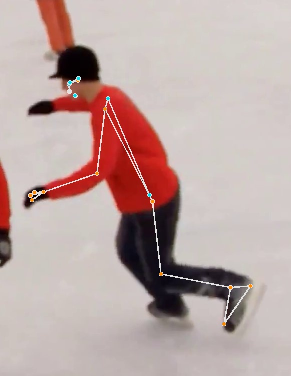 Yolov8upperarm Object Detection Dataset And Pre Trained Model By Tese