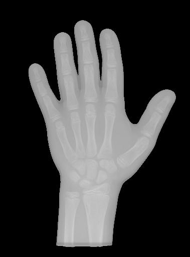 How to Use the X-Ray ID Object Detection API