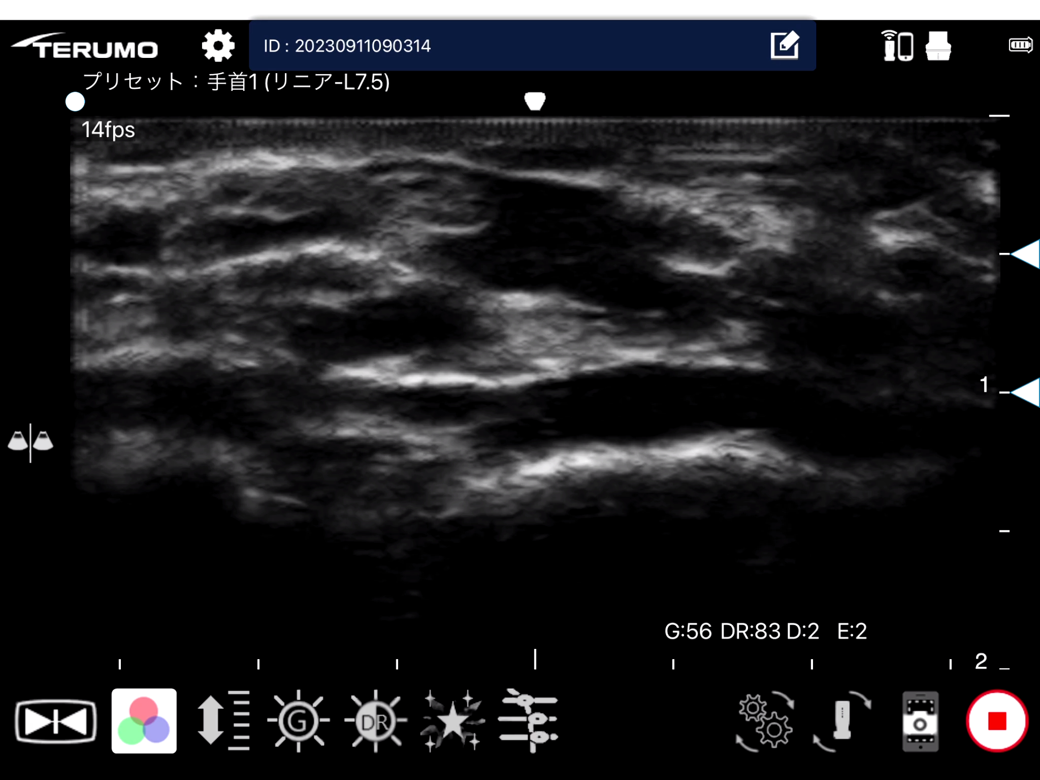 Yolov Object Detection Dataset By New Workspace Iybyy