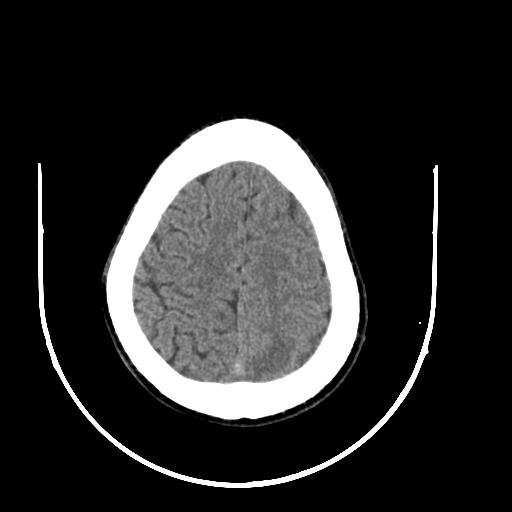 brain_pathology Object Detection Model by AI