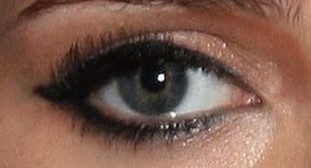 normal eye Object Detection Model by uni