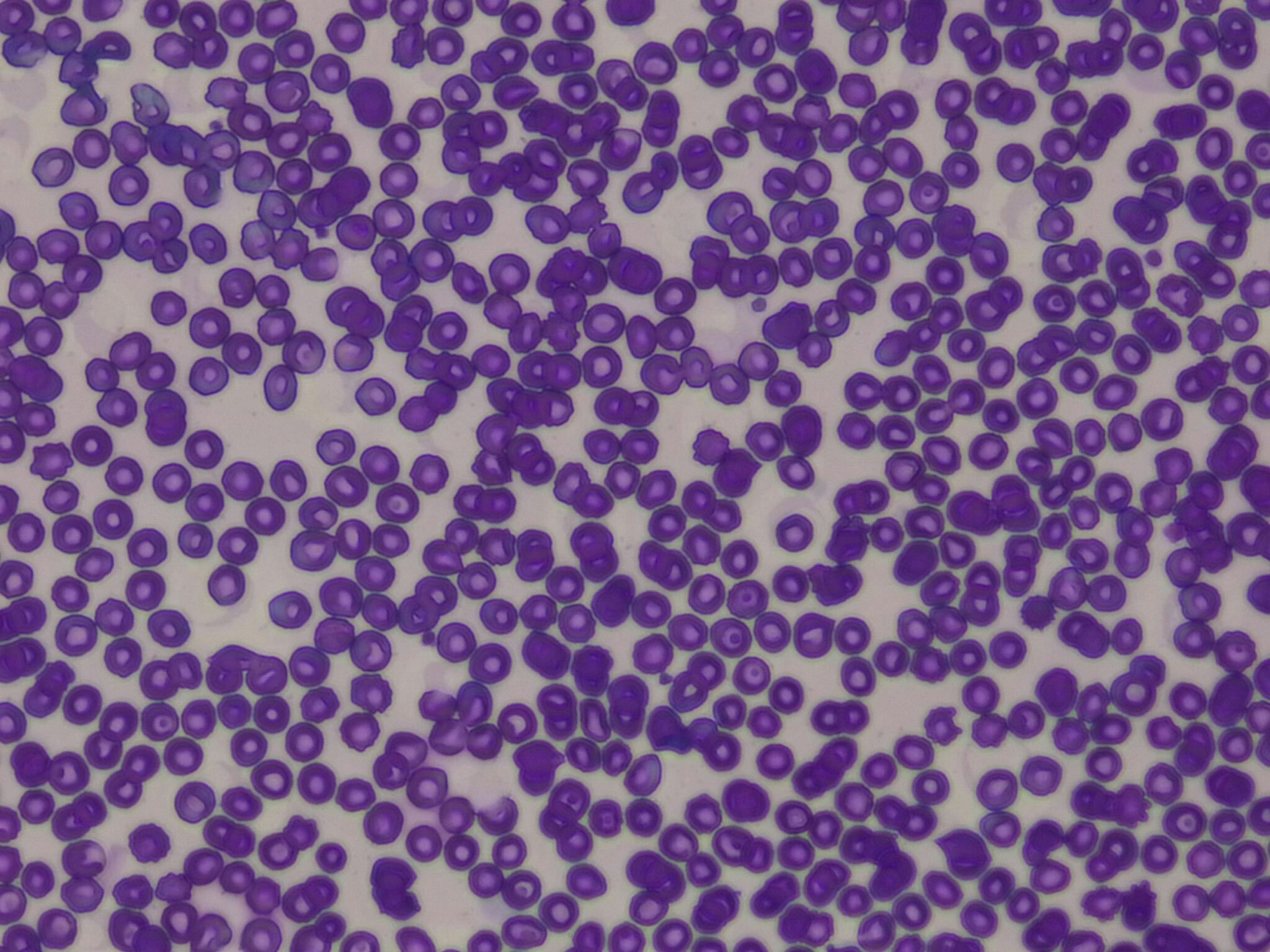 Blood cells object detection Object Detection Model by realtimeprojects