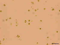 CellDetection - Roboflow Universe