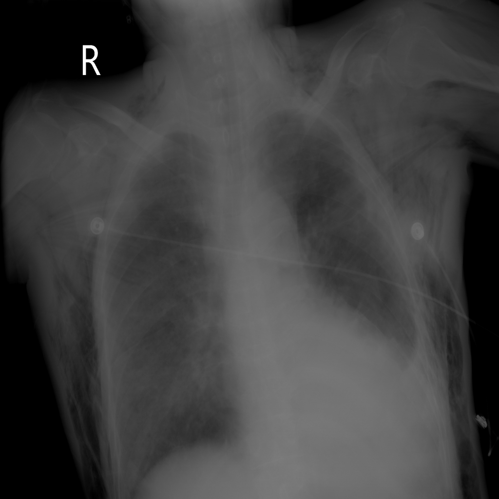 github_code_14_classes Object Detection Dataset by yolo v11