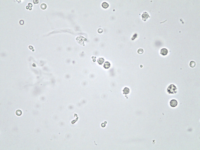 How to Use the Urine-Sediments Object Detection API