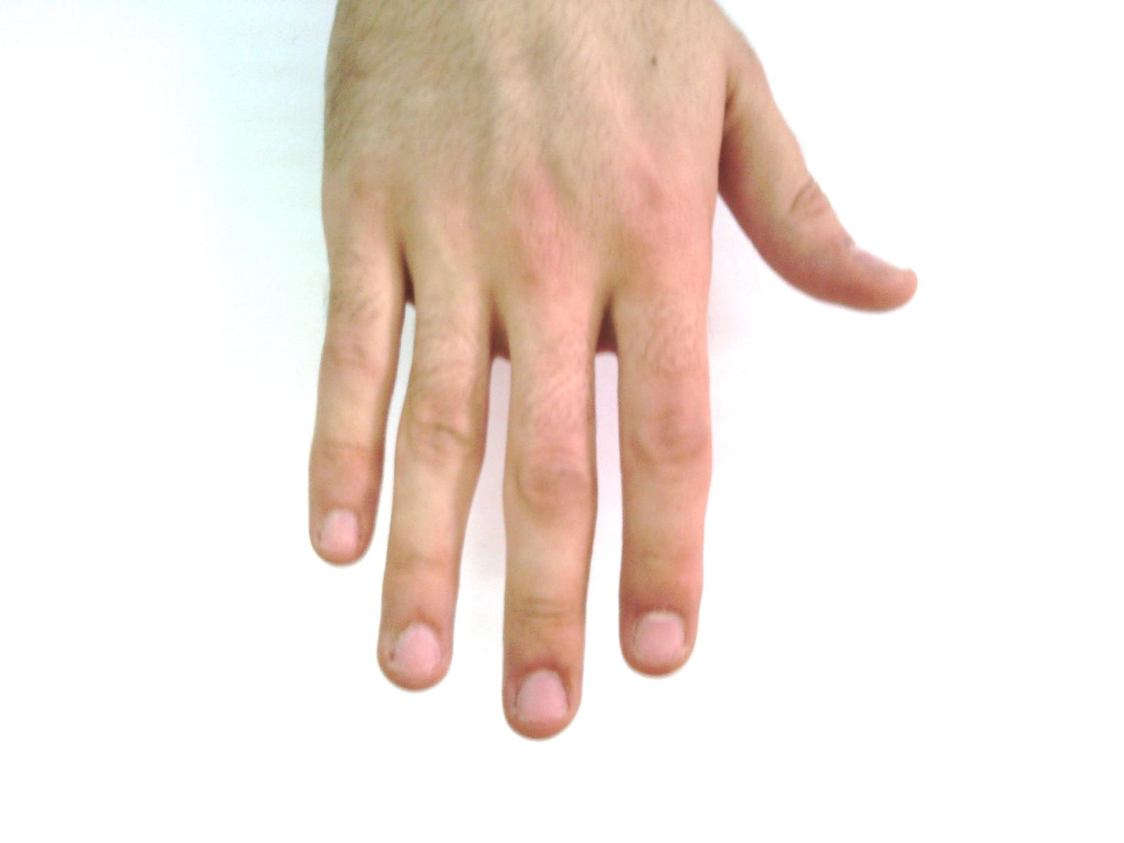 HandPose1 Keypoint Detection Dataset and Pre-Trained Model by Junior Barata