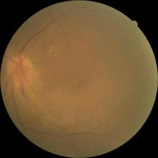 entrnalEyys Classification Dataset by MyWorkSpace