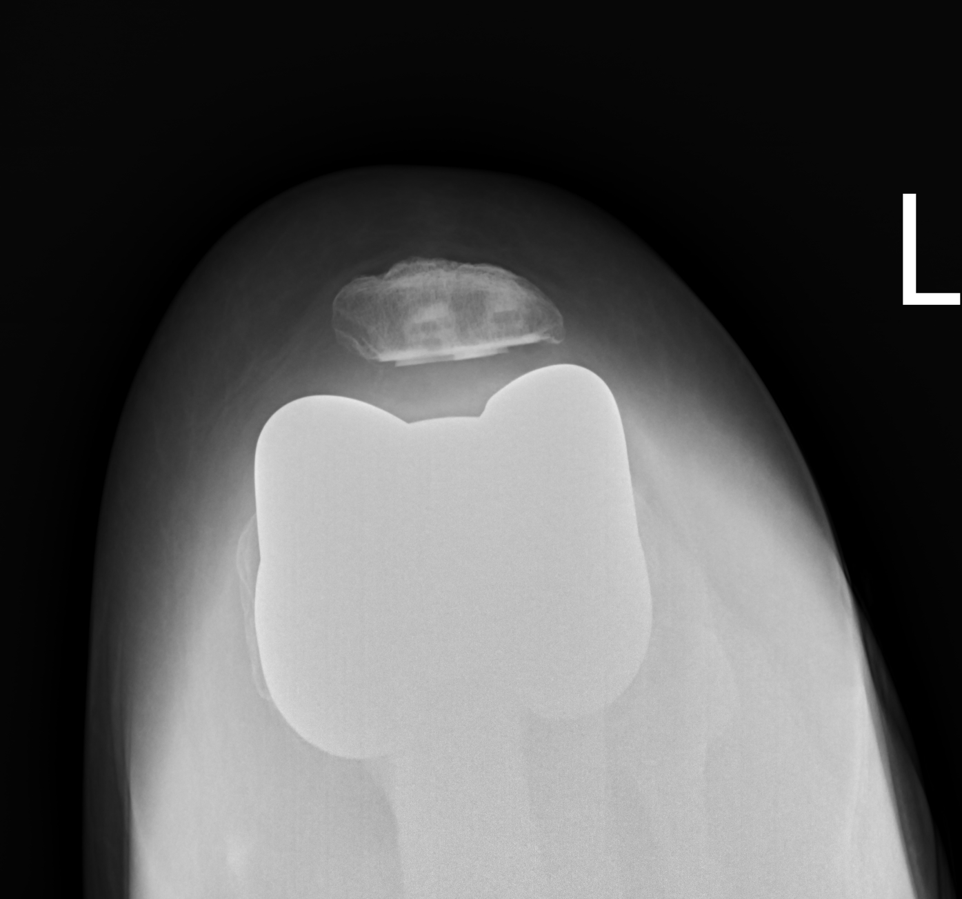 Total Joint Replacement Model Classification Dataset and Pre-Trained ...