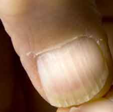 Yolov8-nails-segmentation Instance Segmentation Dataset by chaa