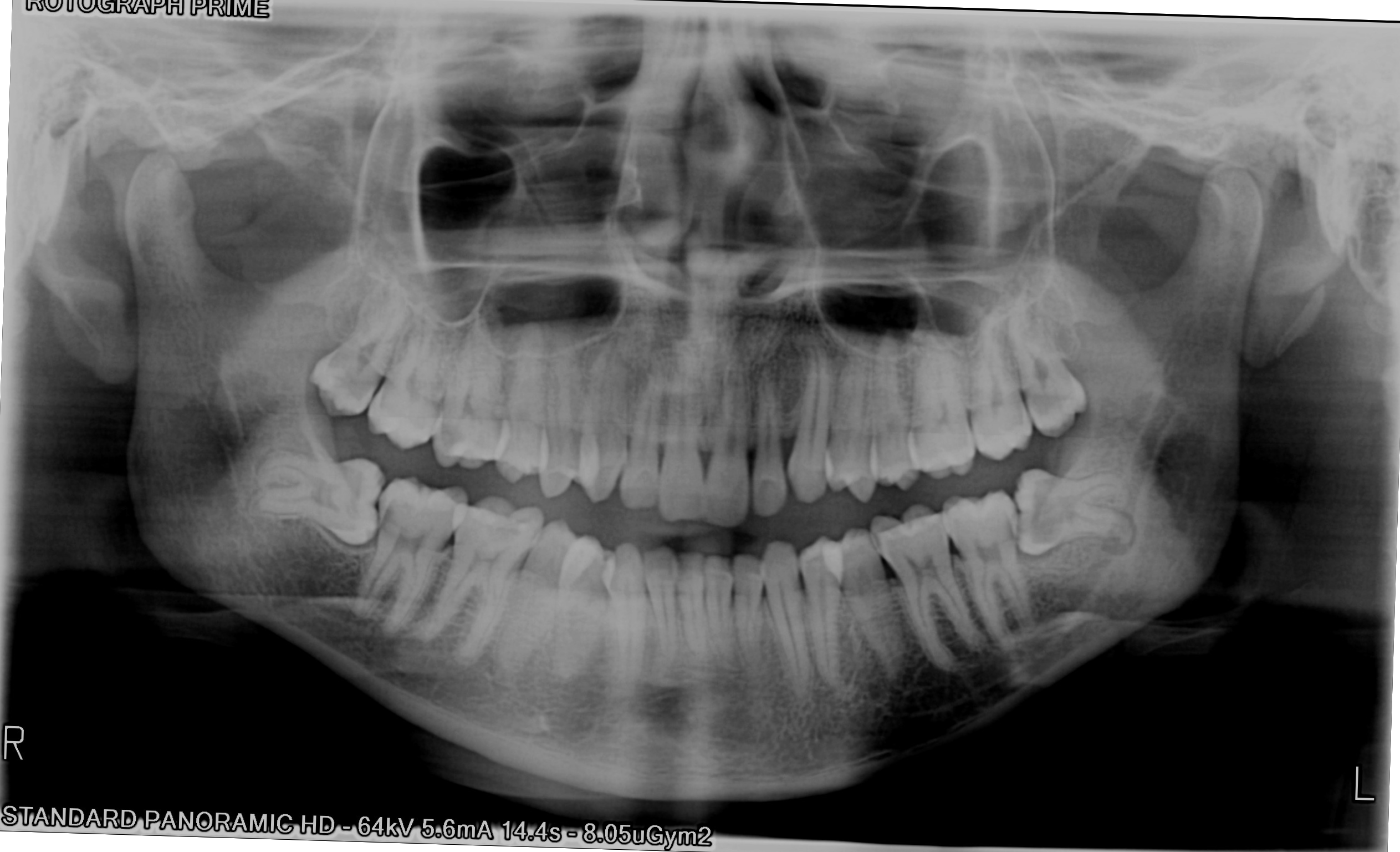 DS Object Detection Dataset by Machine learning based diagnosis of ...