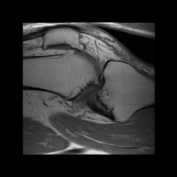 Sagittal Knee MRI Object Detection Model by SungKyunKwan University
