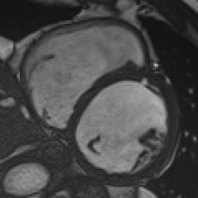 CardioVision - Roboflow Universe