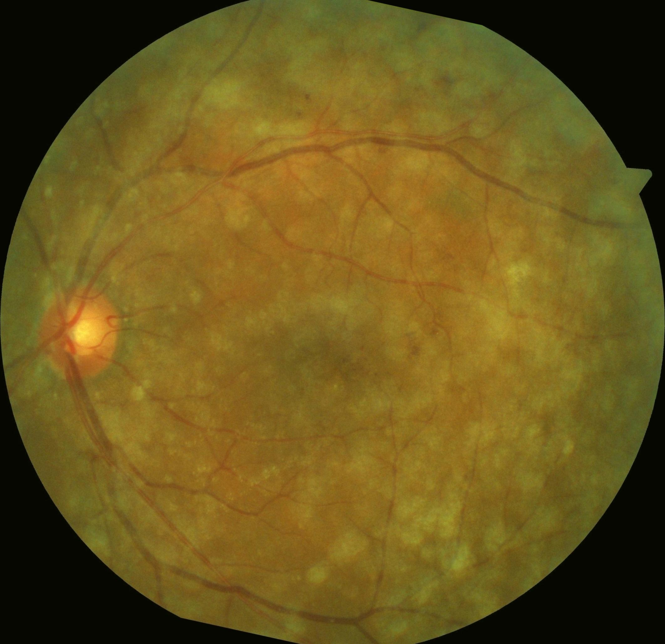 Segment Instance Segmentation Dataset by PRC