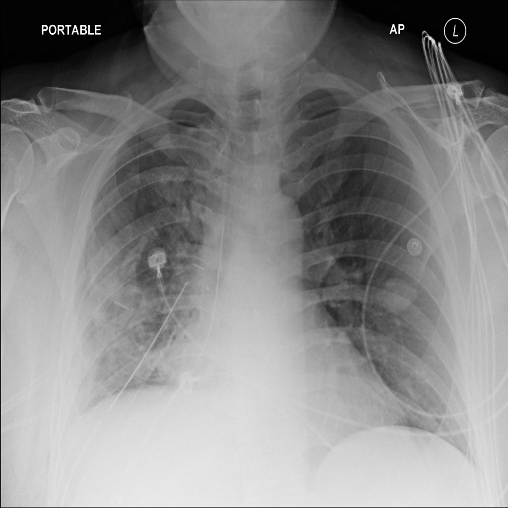 Final degree project - Roboflow Universe