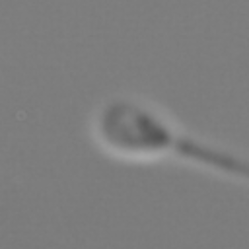 sperm heads 2 Object Detection Model by internet