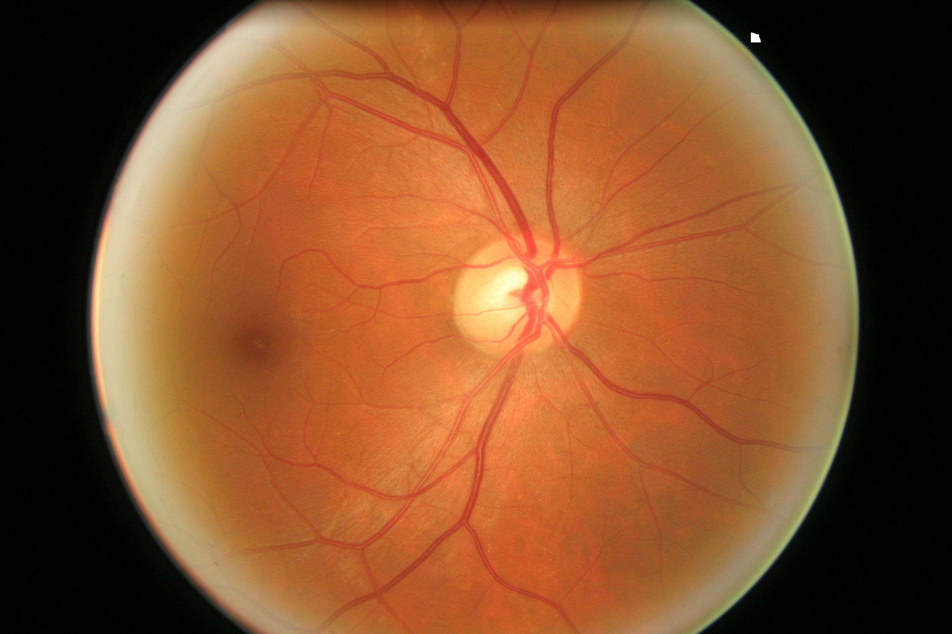 Hariss Workspace - Roboflow Universe